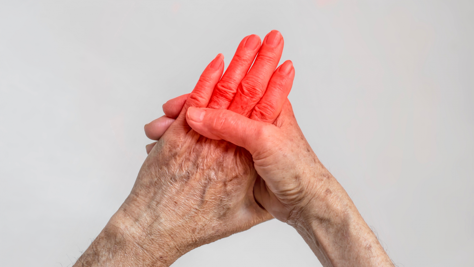 How Successful Is Hand Surgery for Arthritis? - The Nerve Surgery Centre