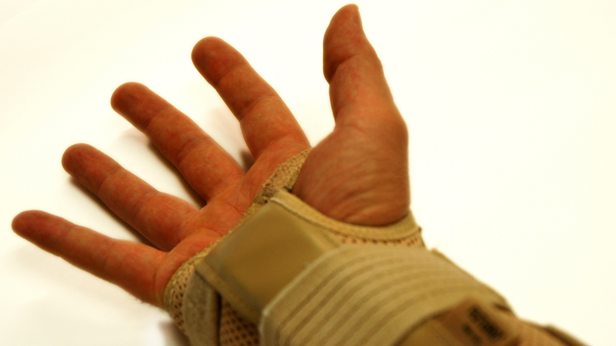 How To Break Up Scar Tissue After Carpal Tunnel Surgery - The Nerve ...